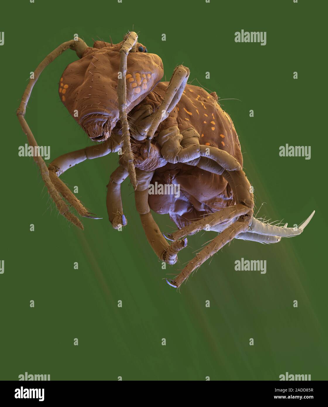 Springtail, coloured scanning electron micrograph (SEM). This arthropod ...