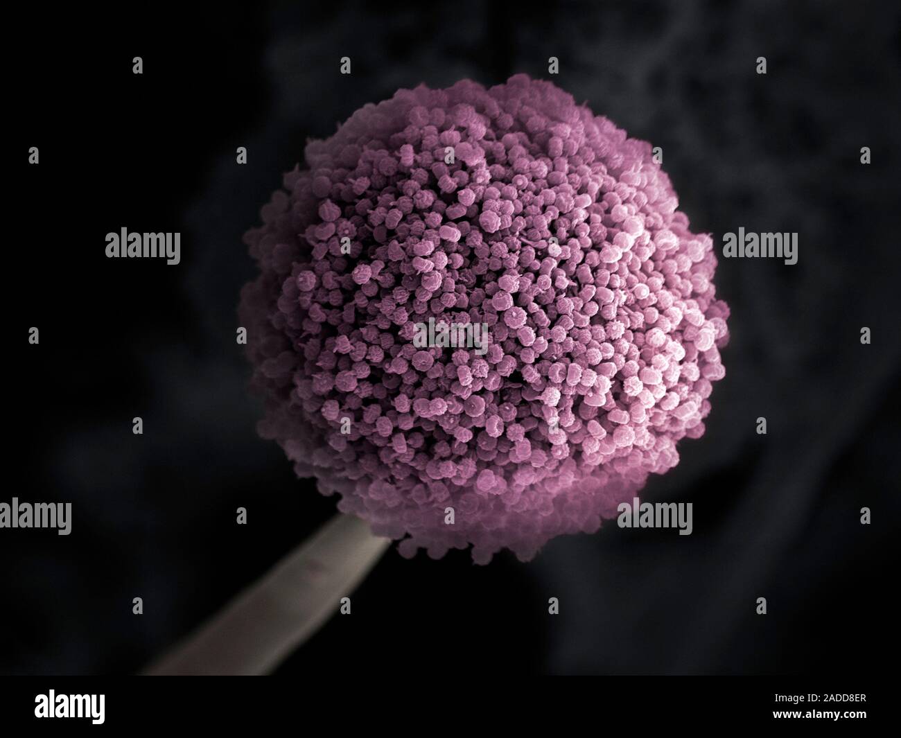 Coloured scanning electron micrograph (SEM) of a fruiting body (conidiophore) of the fungus ...