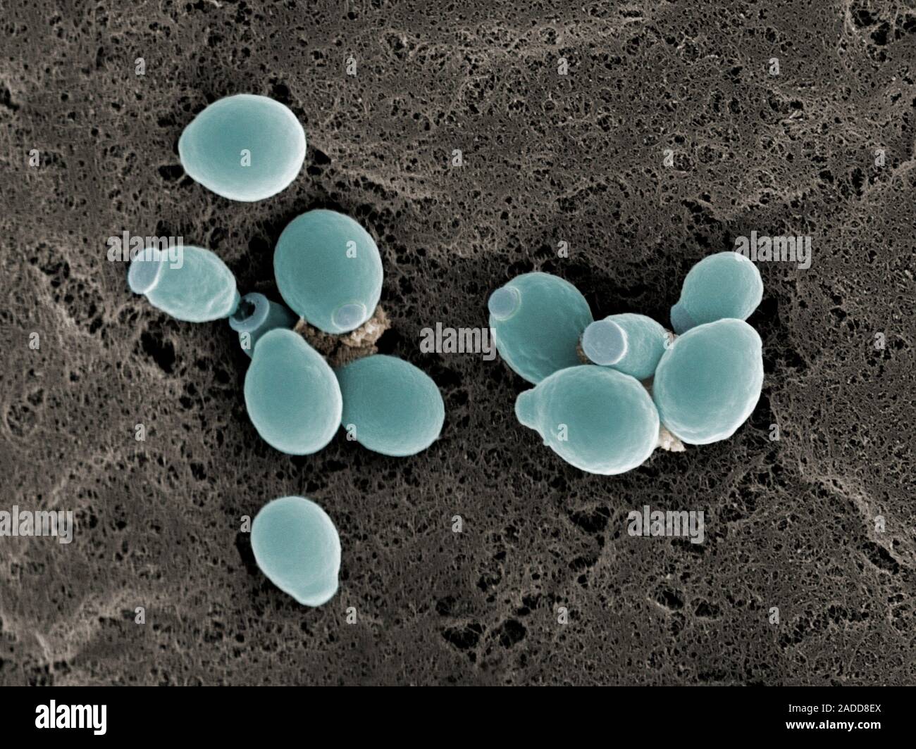 Coloured scanning electron micrograph (SEM) of Candida albicans (yeast ...