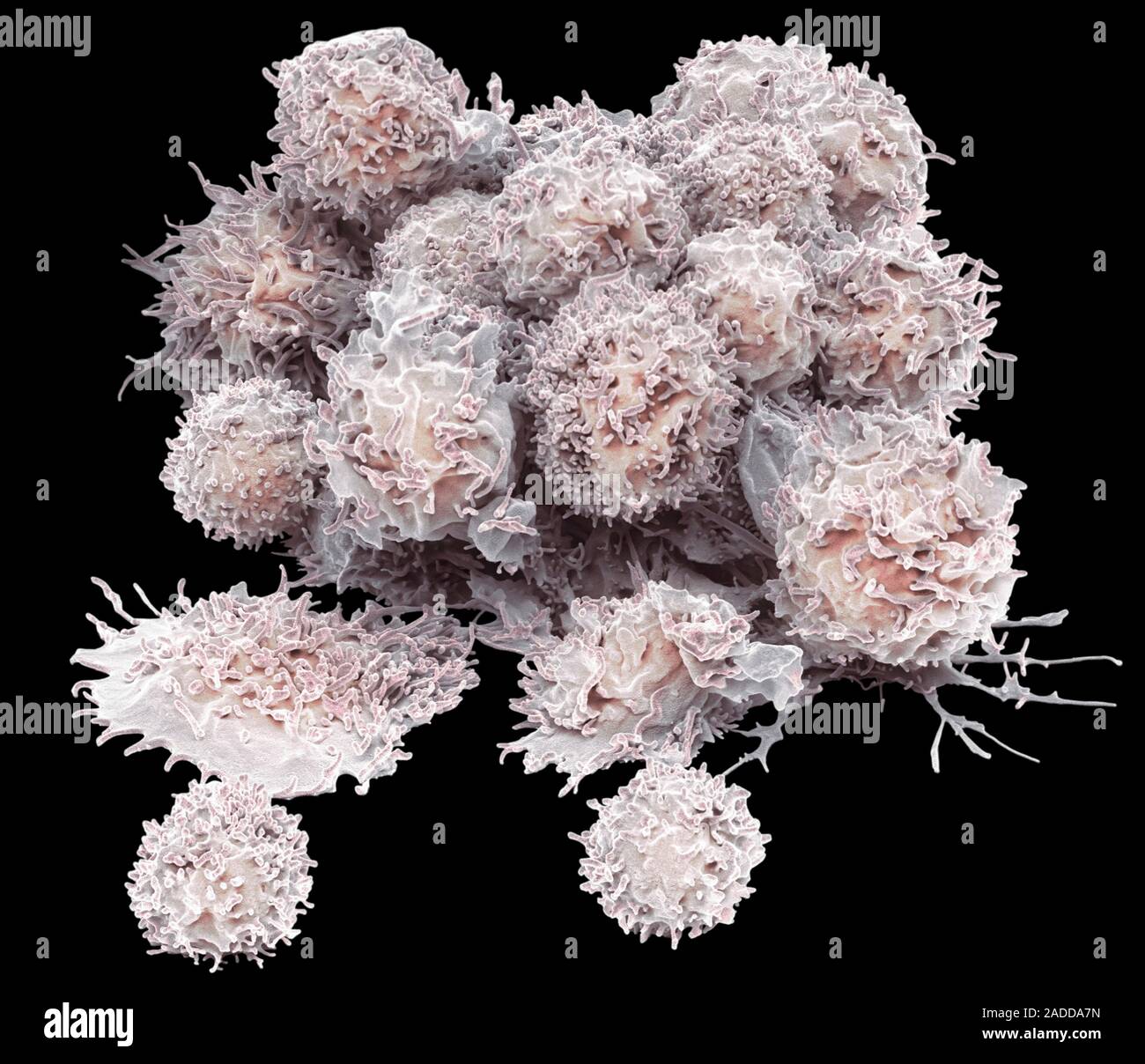 Activated T lymphocytes. Coloured scanning electron micrograph (SEM) of ...