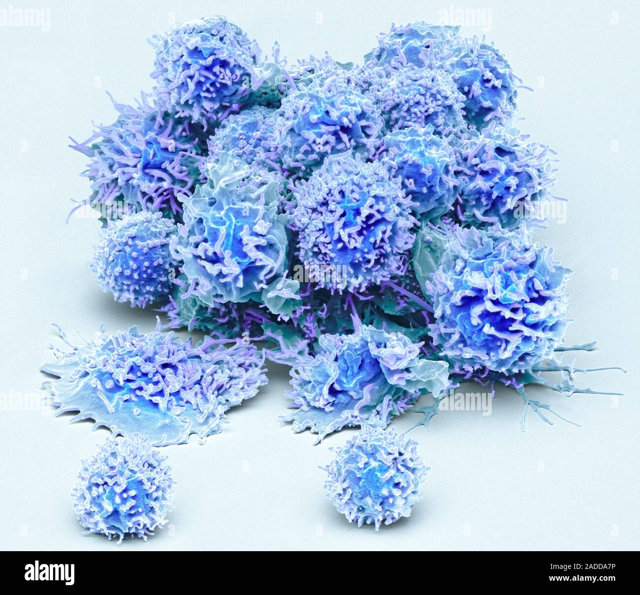 Activated T lymphocytes. Coloured scanning electron micrograph (SEM) of ...