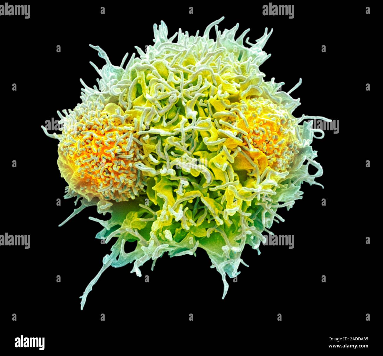 Resting T lymphocyte. Coloured scanning electron micrograph (SEM) of a ...