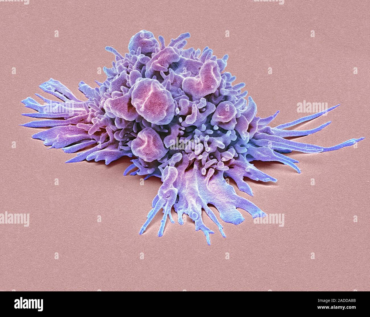 Activated T lymphocyte. Coloured scanning electron micrograph (SEM) of ...