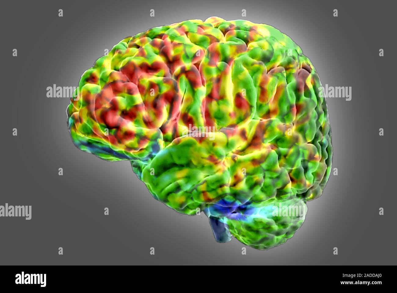 Human brain's left hemisphere. Coloured functional magnetic resonance ...