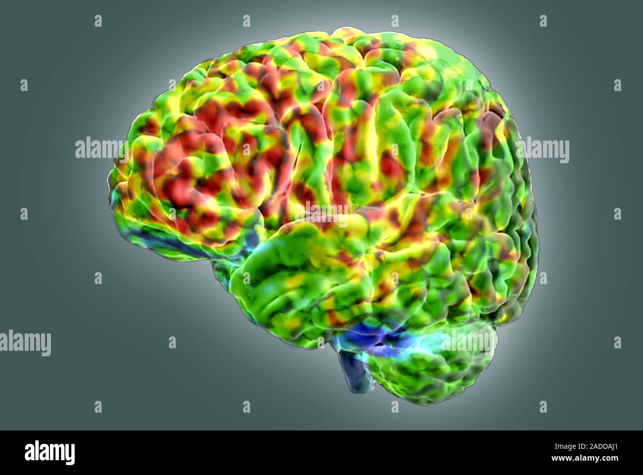 Human brain's left hemisphere. Coloured functional magnetic resonance ...