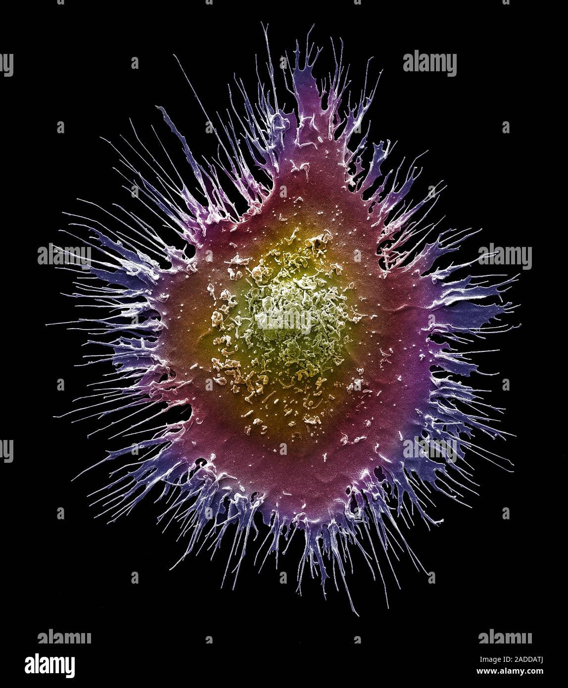 Dendritic cell. Coloured scanning electron micrograph (SEM) of a ...