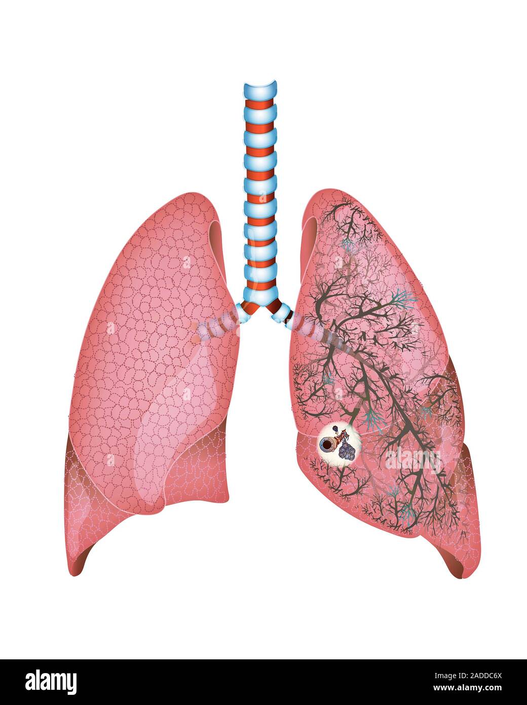 Illustration of the human lungs. The trachea (windpipe) leads from the ...