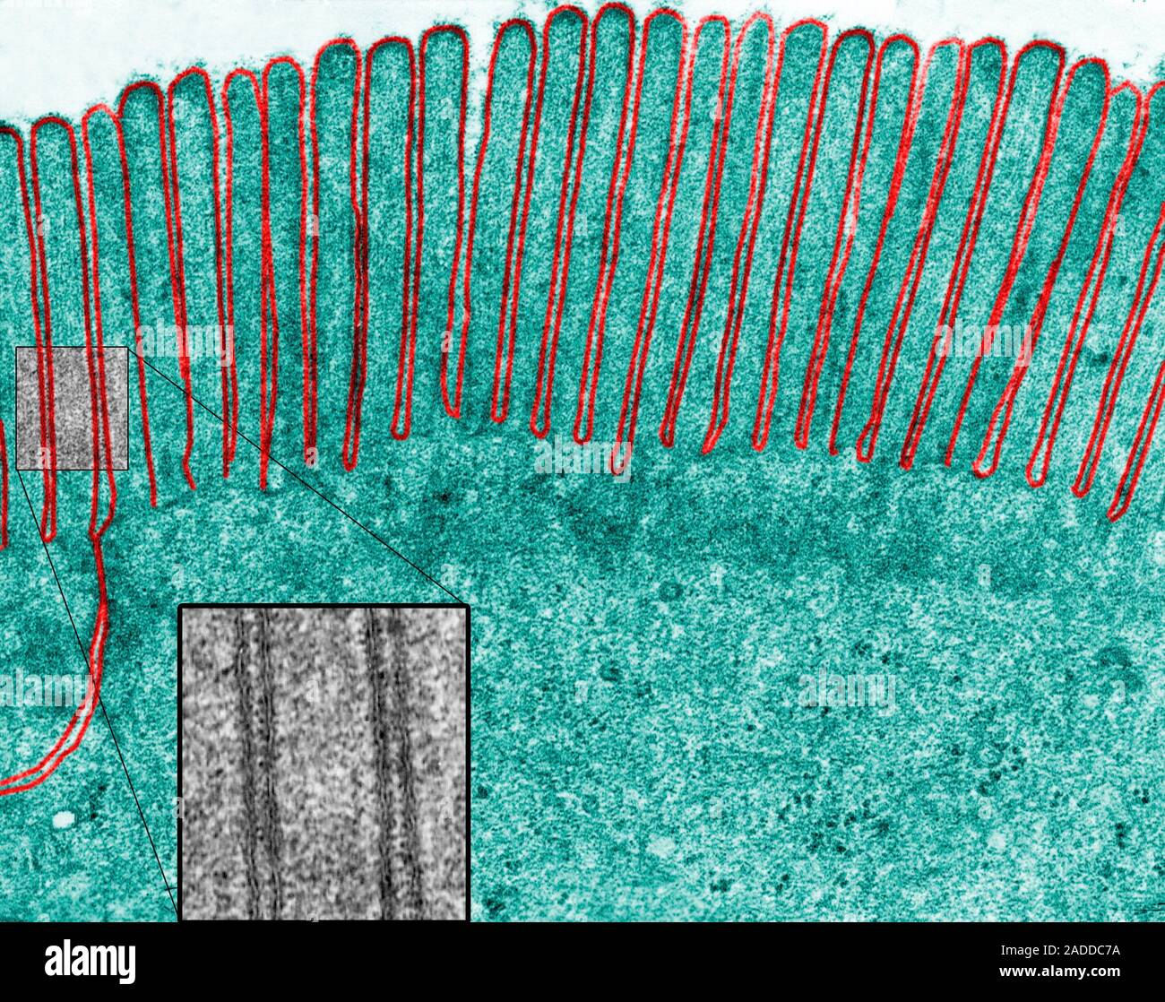 Coloured transmission electron micrograph (TEM) showing the plasma ...