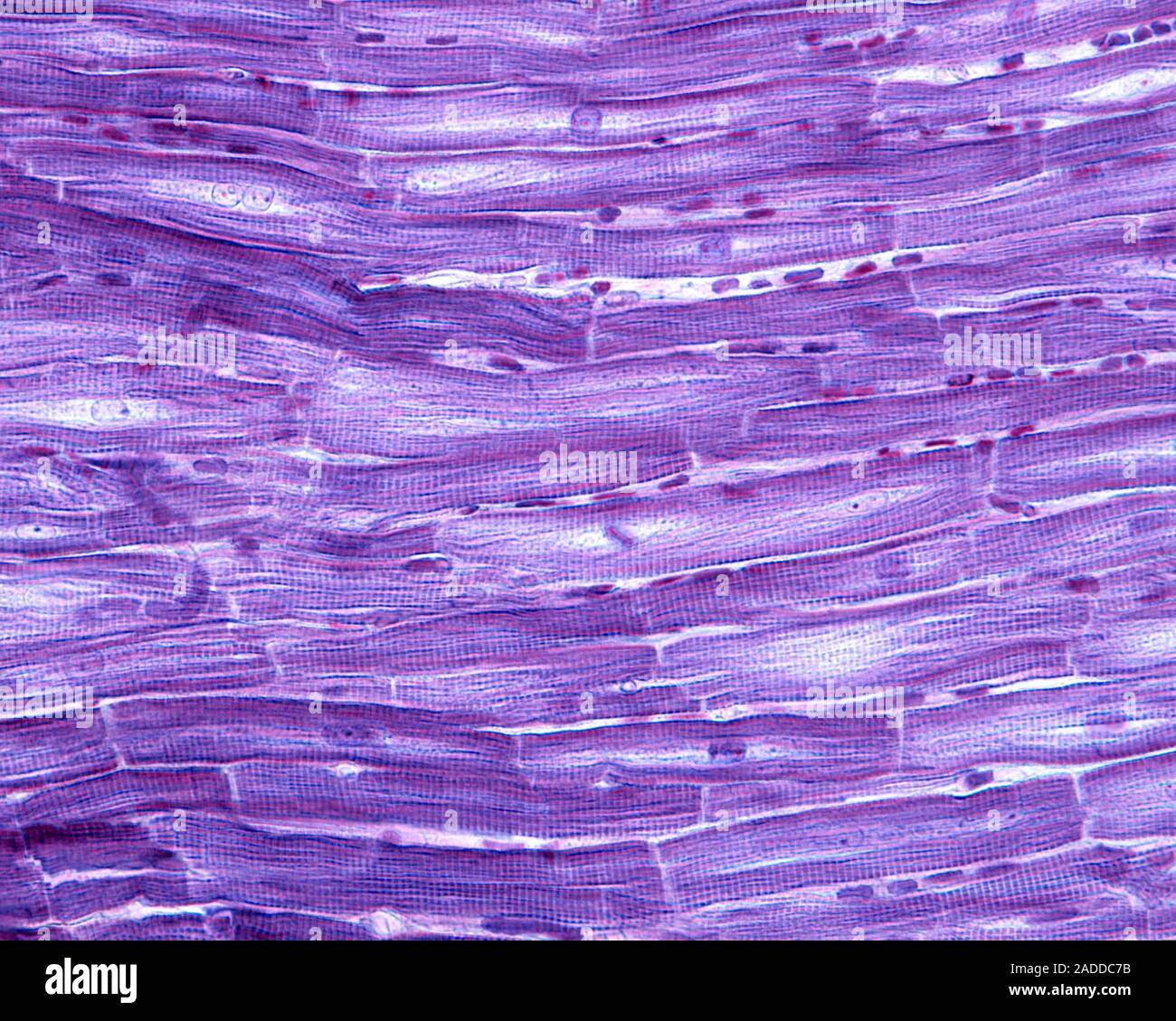 Striated muscle fibres of the heart myocardium stained with Mallory's ...