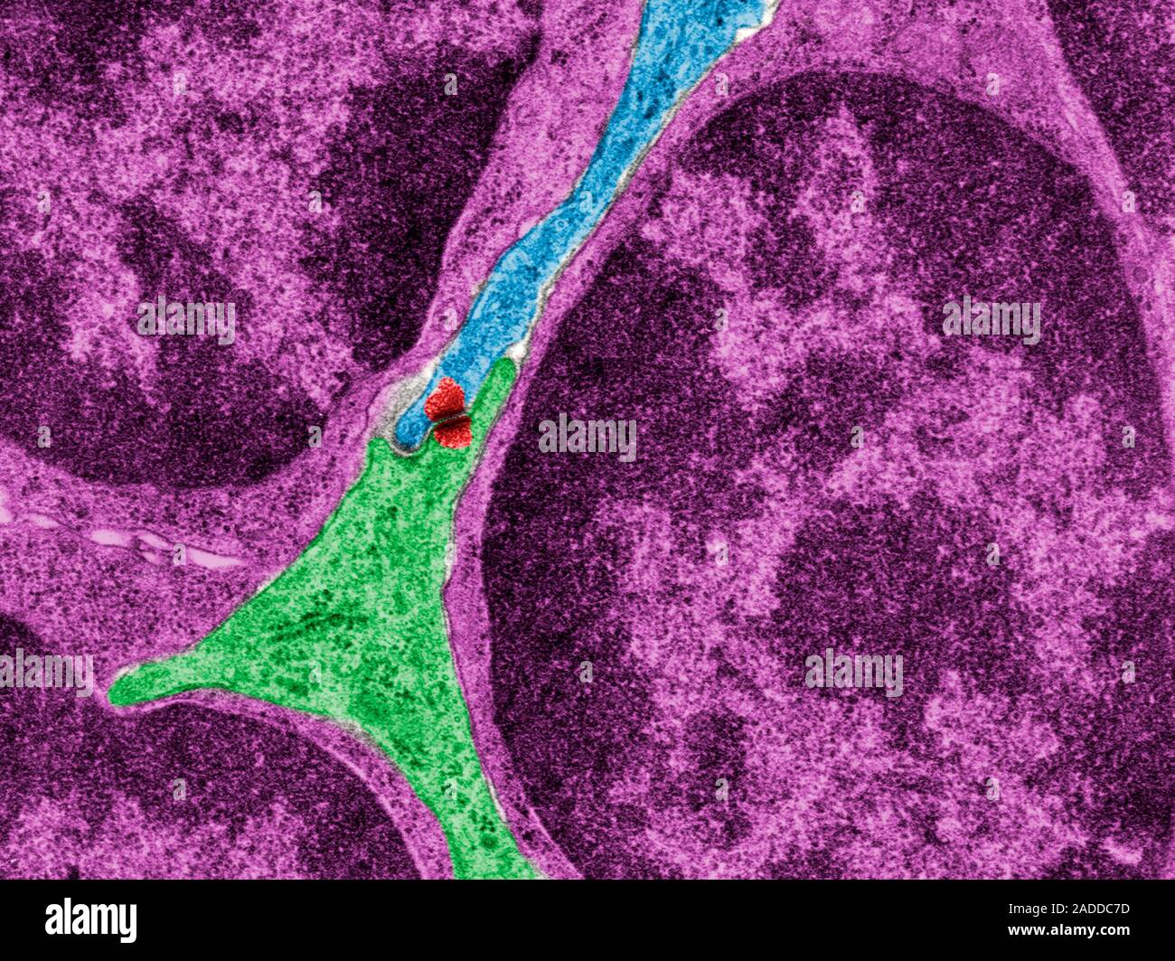 Coloured transmission electron micrograph (TEM) of a section through ...