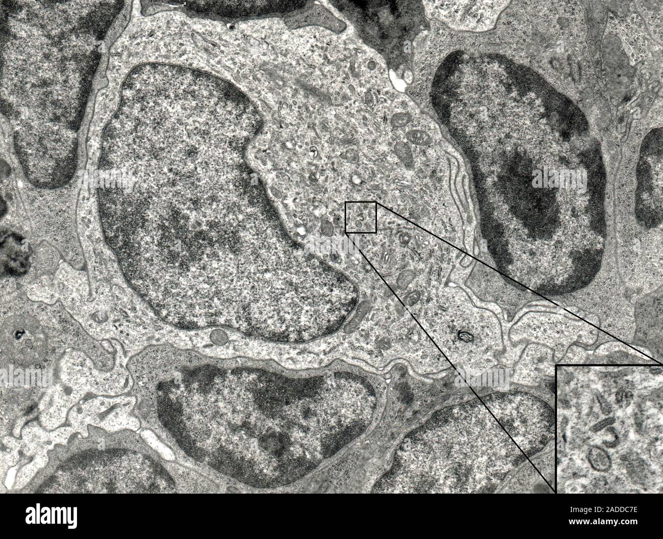 Transmission electron micrograph (TEM) of a macrophage white blood cell ...