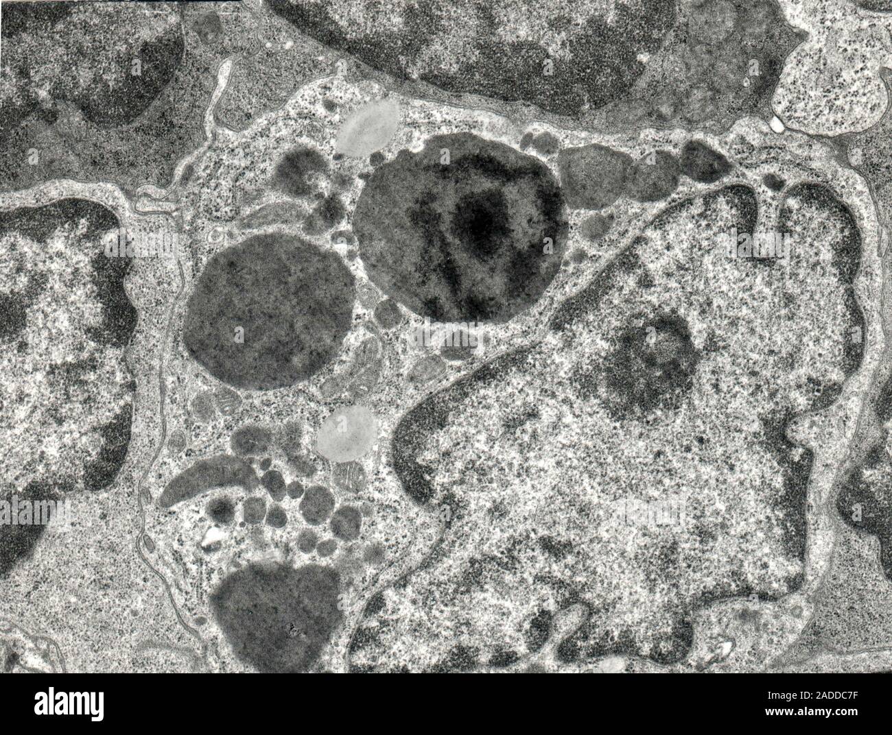 Transmission electron micrograph (TEM) of a section through a ...