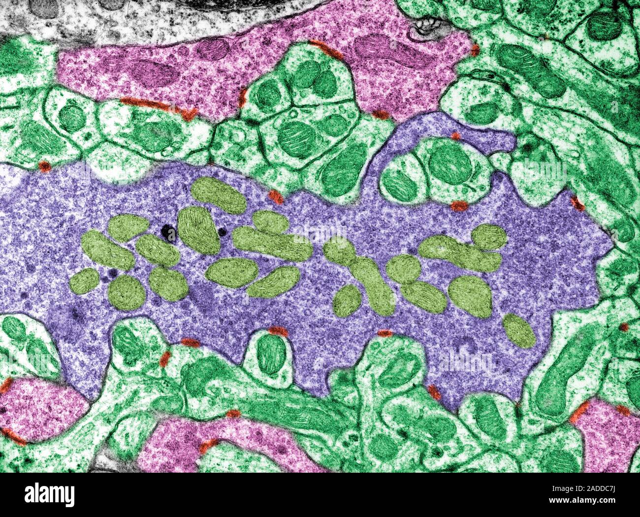 Coloured transmission electron micrograph (TEM) of a section through a ...