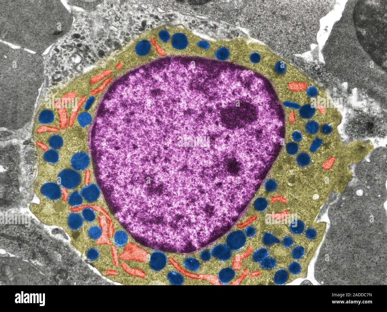 Coloured transmission electron micrograph (TEM) showing a promyelocyte ...