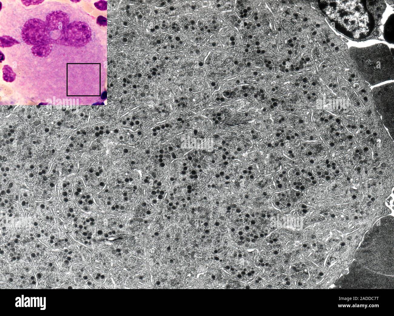 Transmission electron micrograph (TEM) with light micrograph inset of a ...