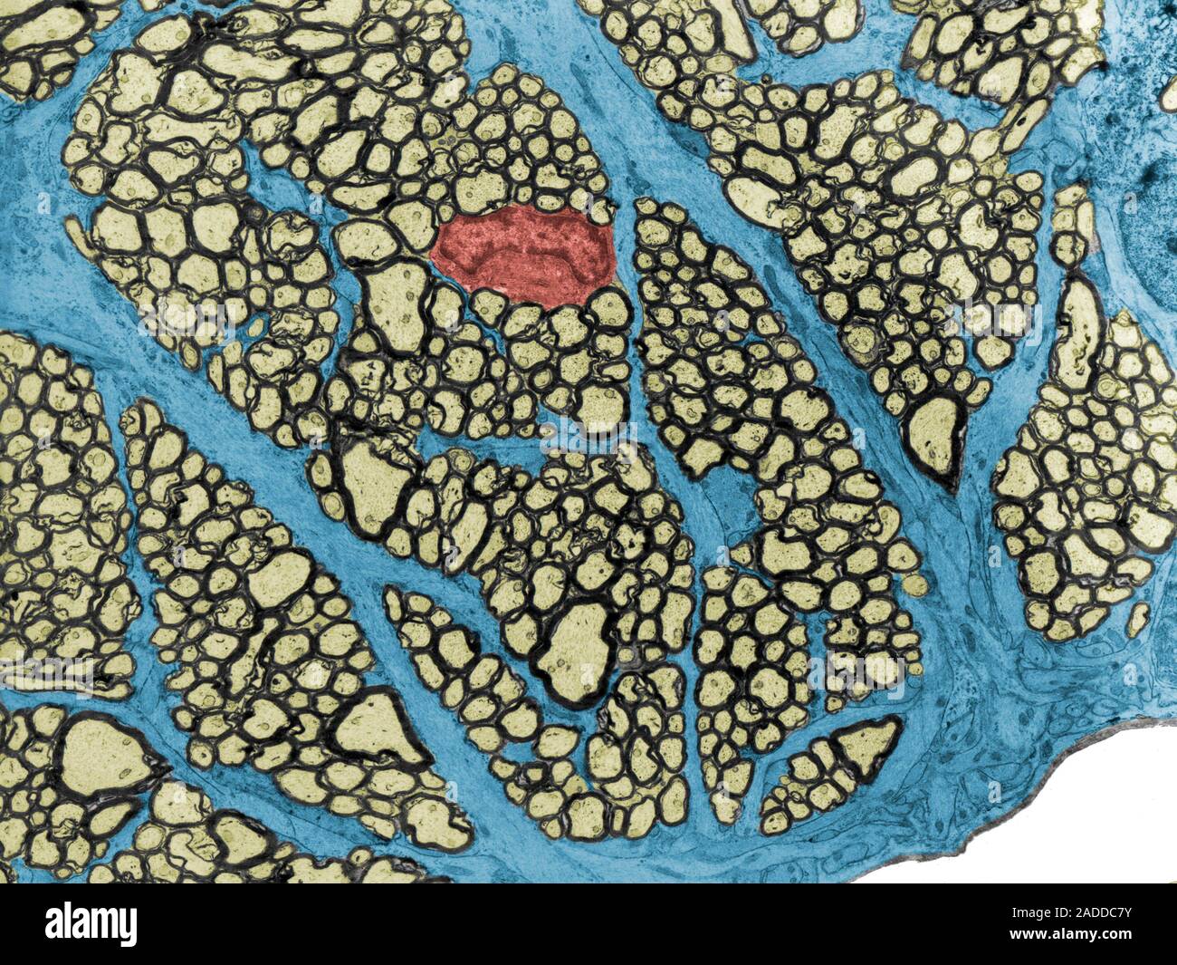 Coloured transmission electron micrograph (TEM) of a cross-section ...