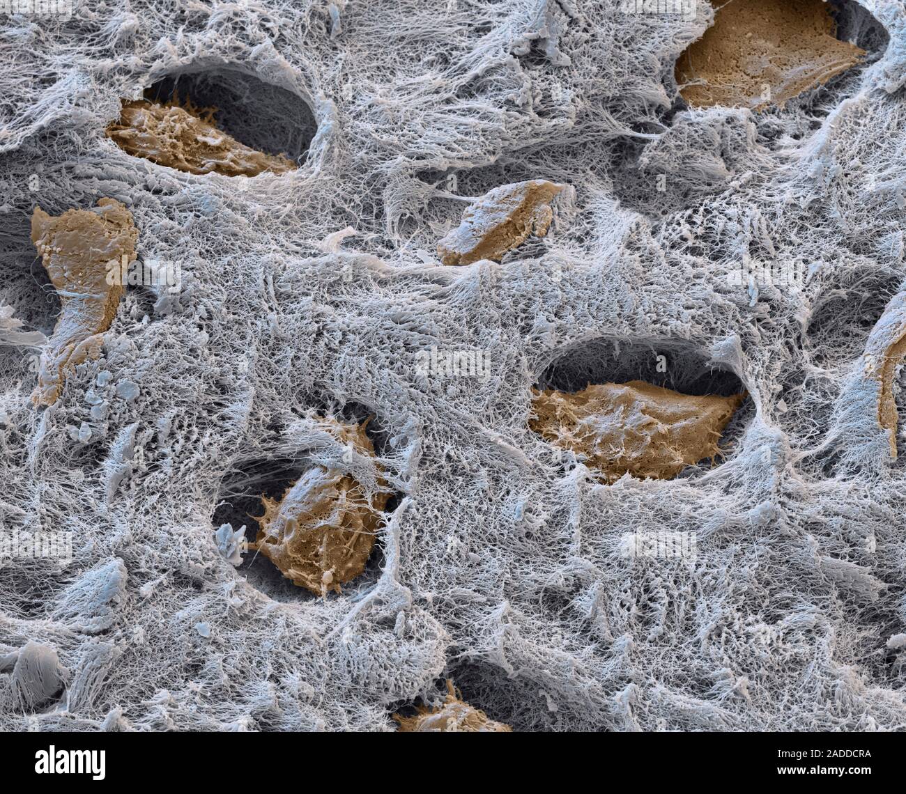 Cartilage cells and bone tissue, coloured scanning electron micrograph ...