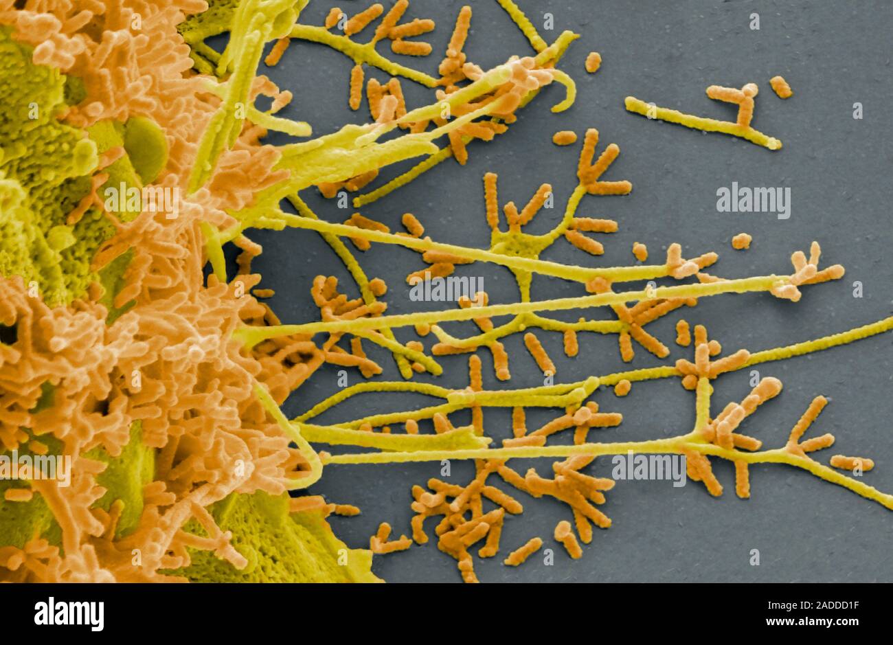 Human cells infected with influenza virus, coloured scanning electron ...