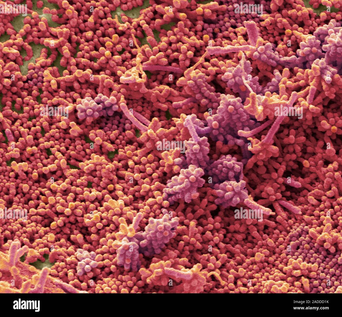 Human cells infected with influenza virus, coloured scanning electron ...