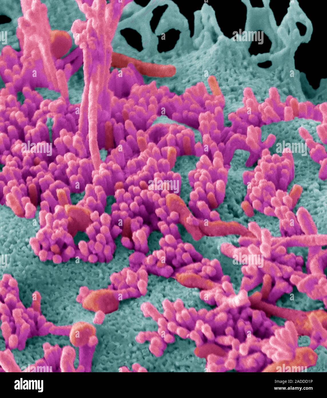 Human cells infected with influenza virus, coloured scanning electron ...