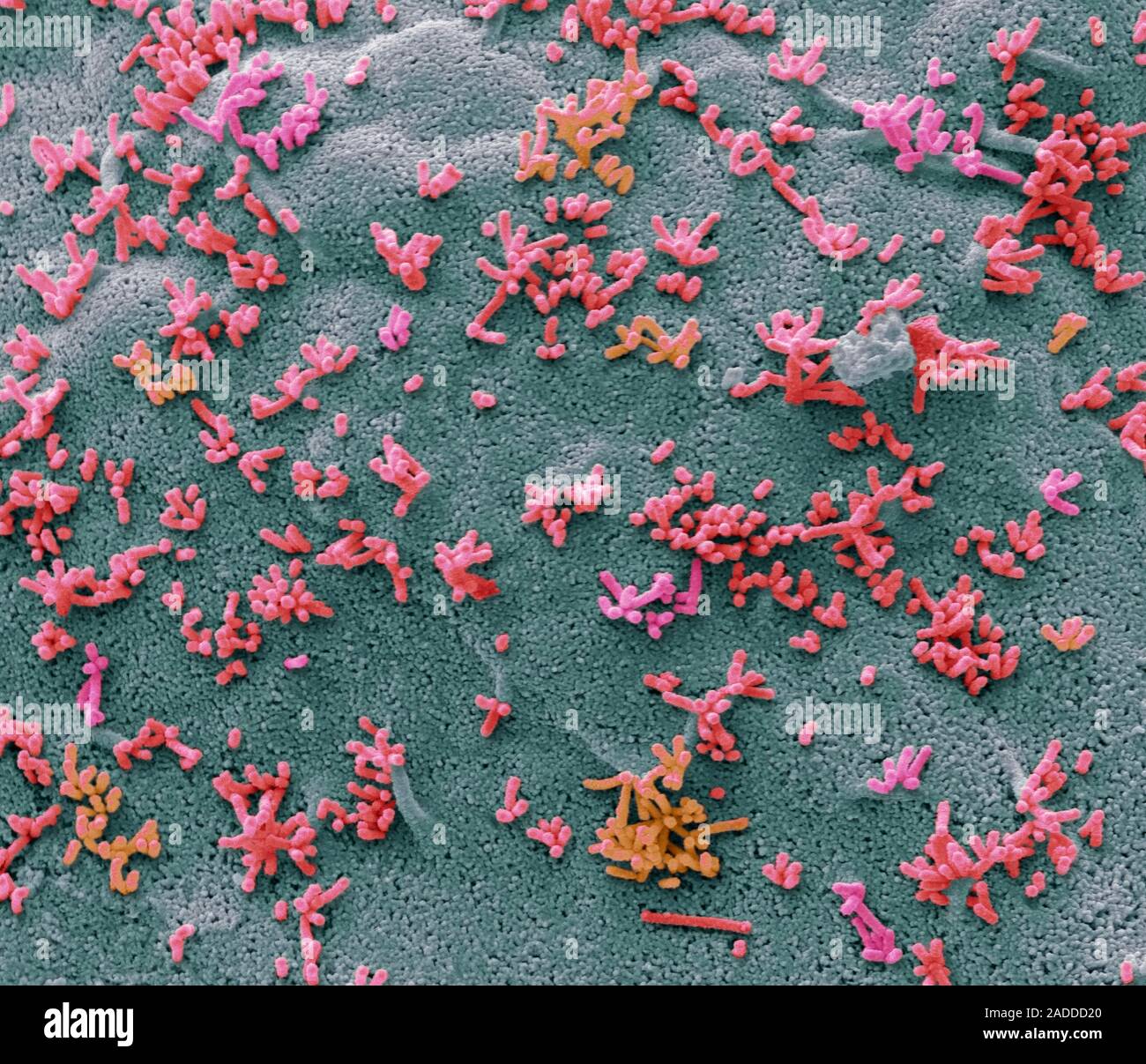 Human cells infected with influenza virus, coloured scanning electron ...