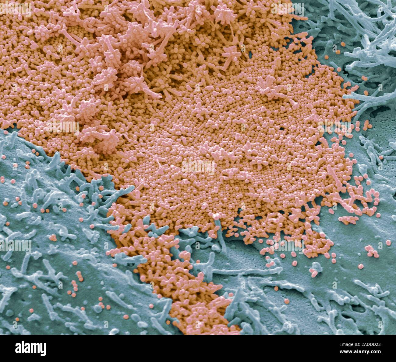 Human cells infected with influenza virus, coloured scanning electron ...