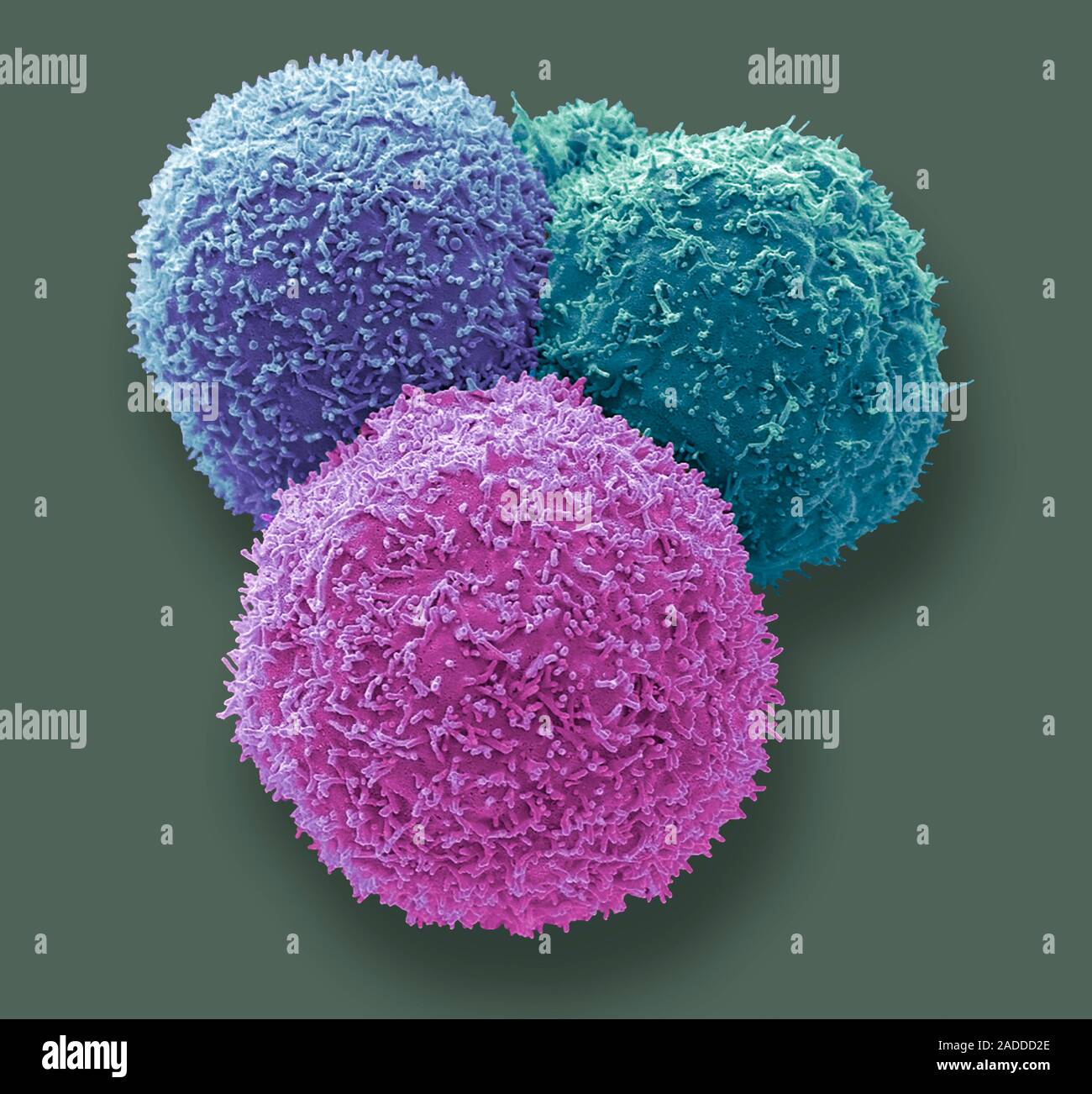 Coloured scanning electron micrograph (SEM) of Madin-Darby Canine ...