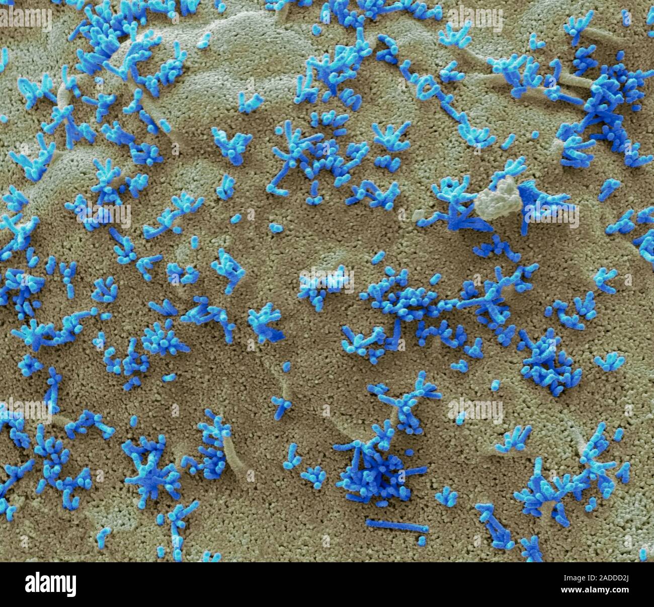 Human cells infected with influenza virus, coloured scanning electron ...