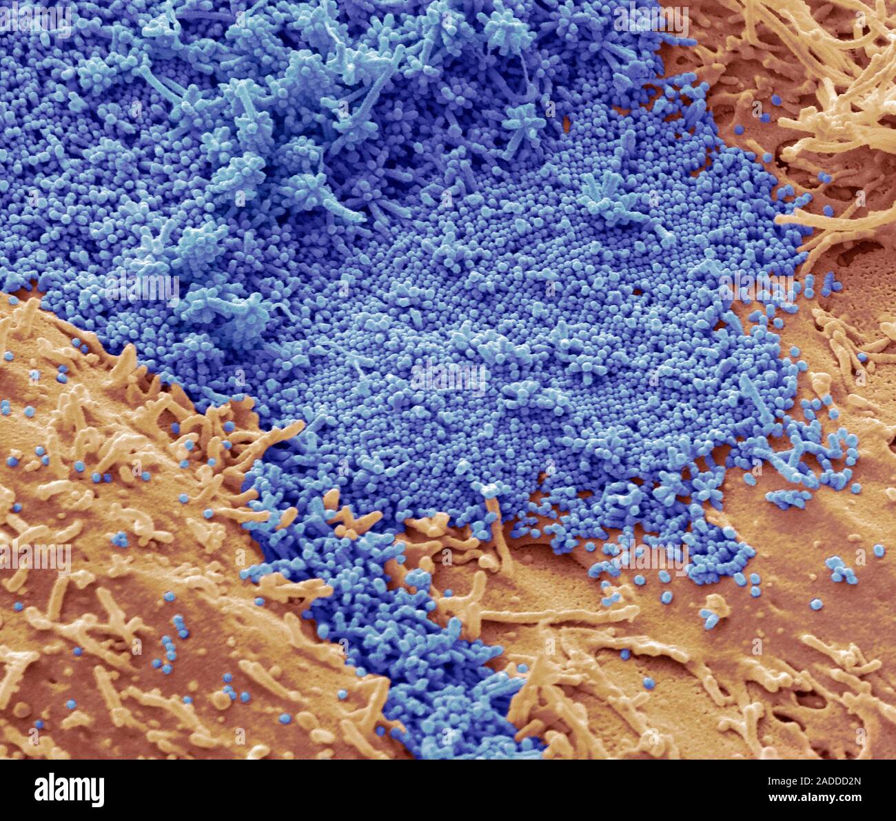 Human cells infected with influenza virus, coloured scanning electron ...