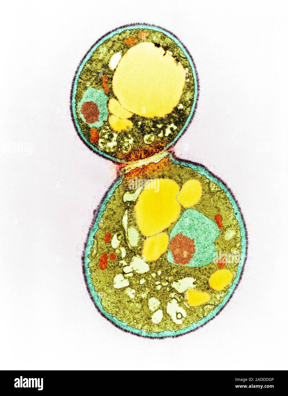 Coloured transmission electron micrograph (TEM) of a freeze-fracture ...