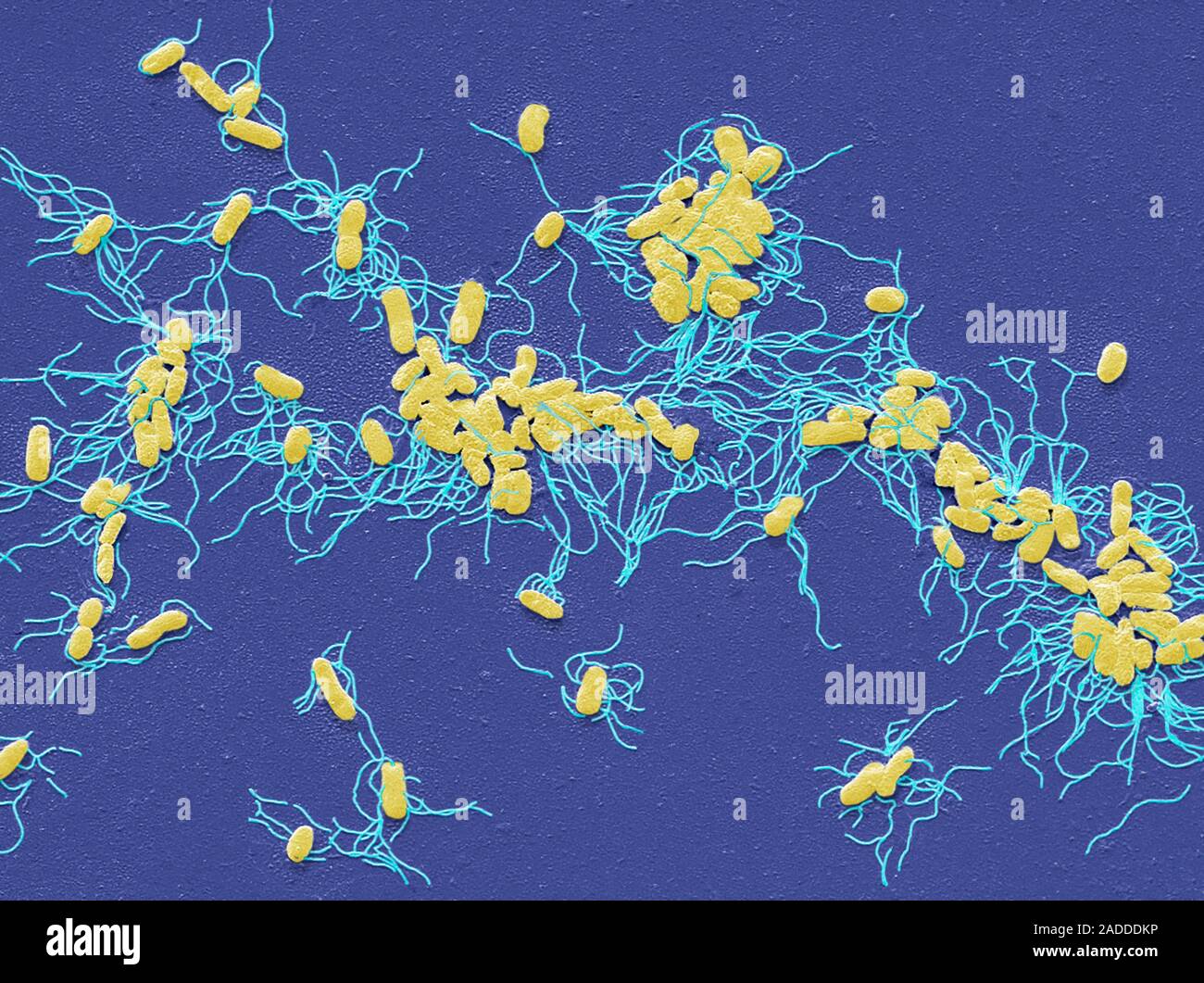 Salmonella typhi. Coloured scanning electron micrograph (SEM) of ...