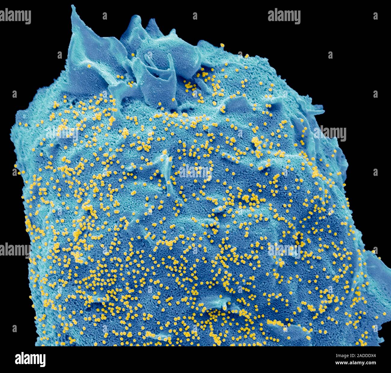 Human cells infected with influenza B virus, coloured scanning electron ...