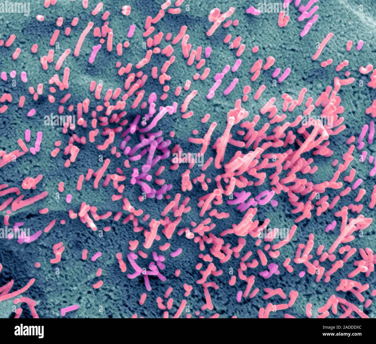 Human cells infected with bird flu virus, coloured scanning electron ...