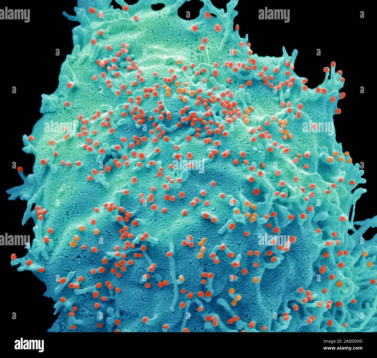 Coloured scanning electron micrograph (SEM) of human cells infected ...
