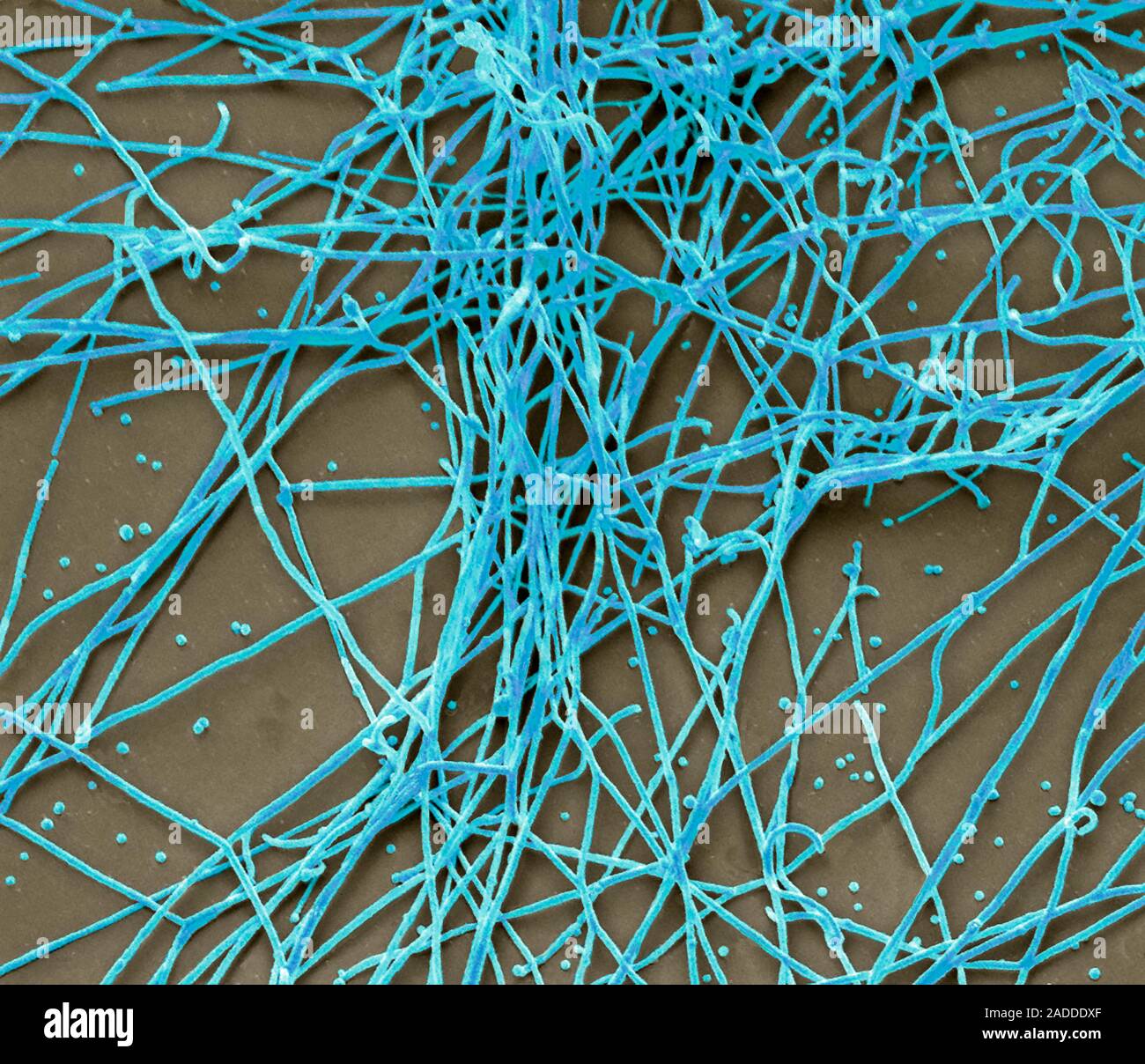 Coloured scanning electron micrograph (SEM) of virus particles from ...
