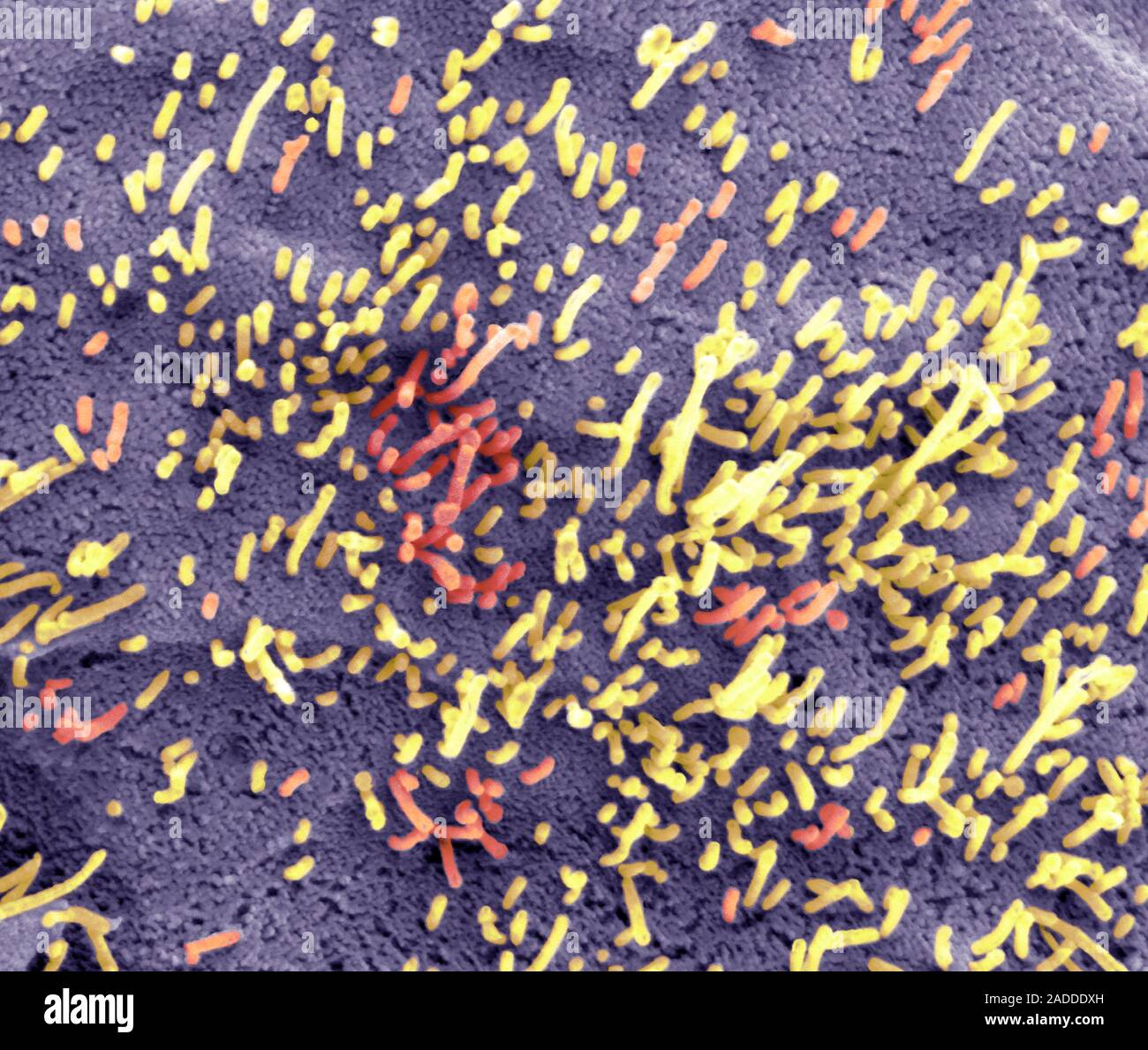 Human cells infected with bird flu virus, coloured scanning electron ...