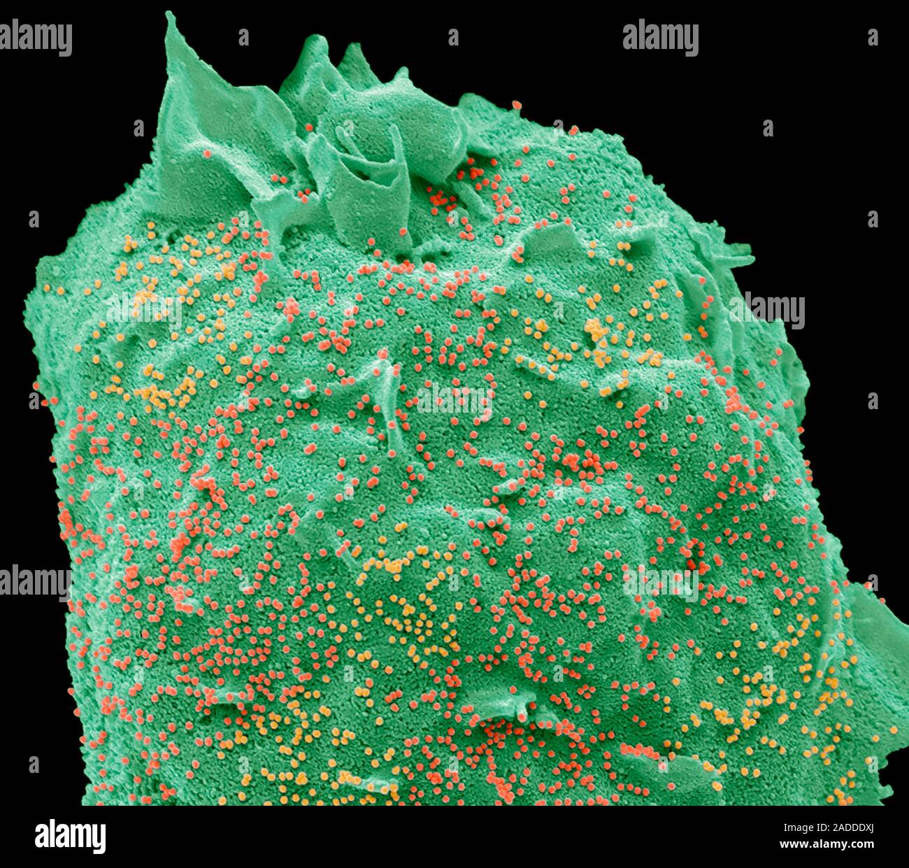 Human cells infected with influenza B virus, coloured scanning electron ...