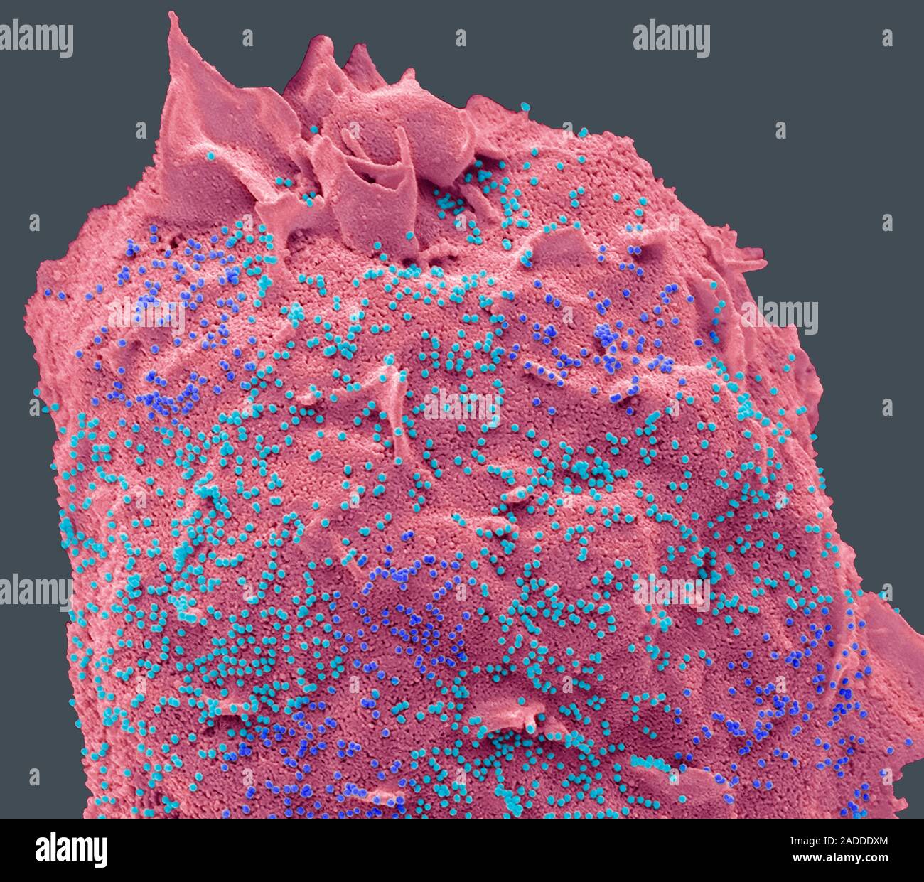 Human cells infected with influenza B virus, coloured scanning electron ...