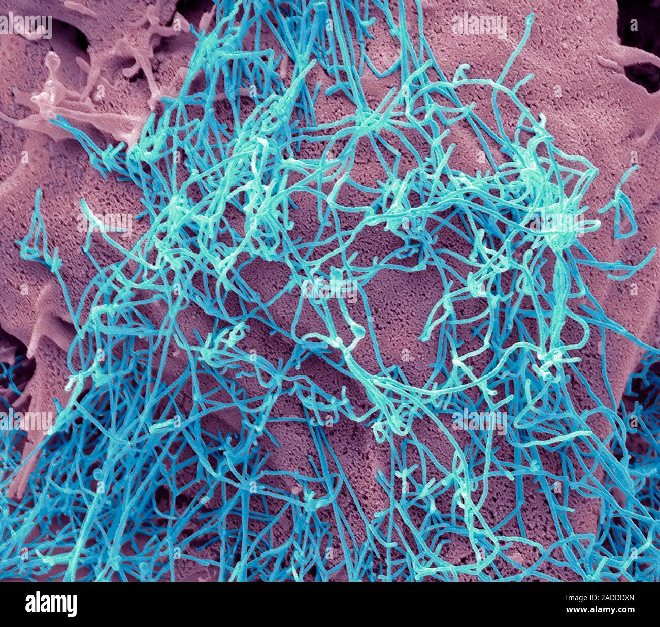 Coloured scanning electron micrograph (SEM) of human cells infected ...