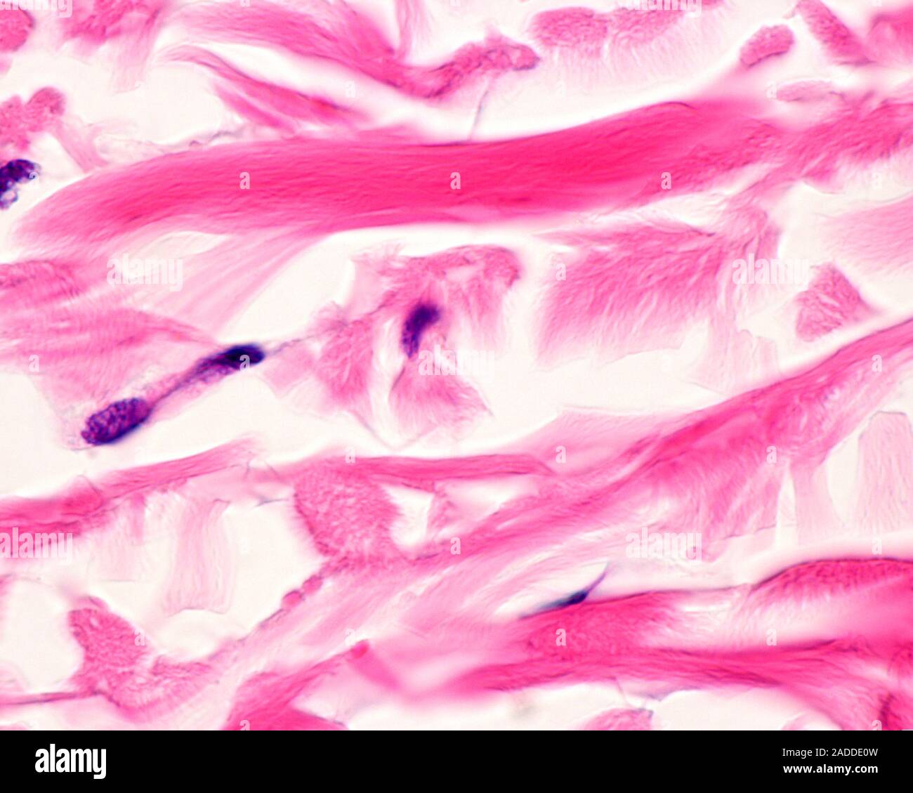 Collagen fibres, light micrograph. Collagen fibres (pink) forming large ...