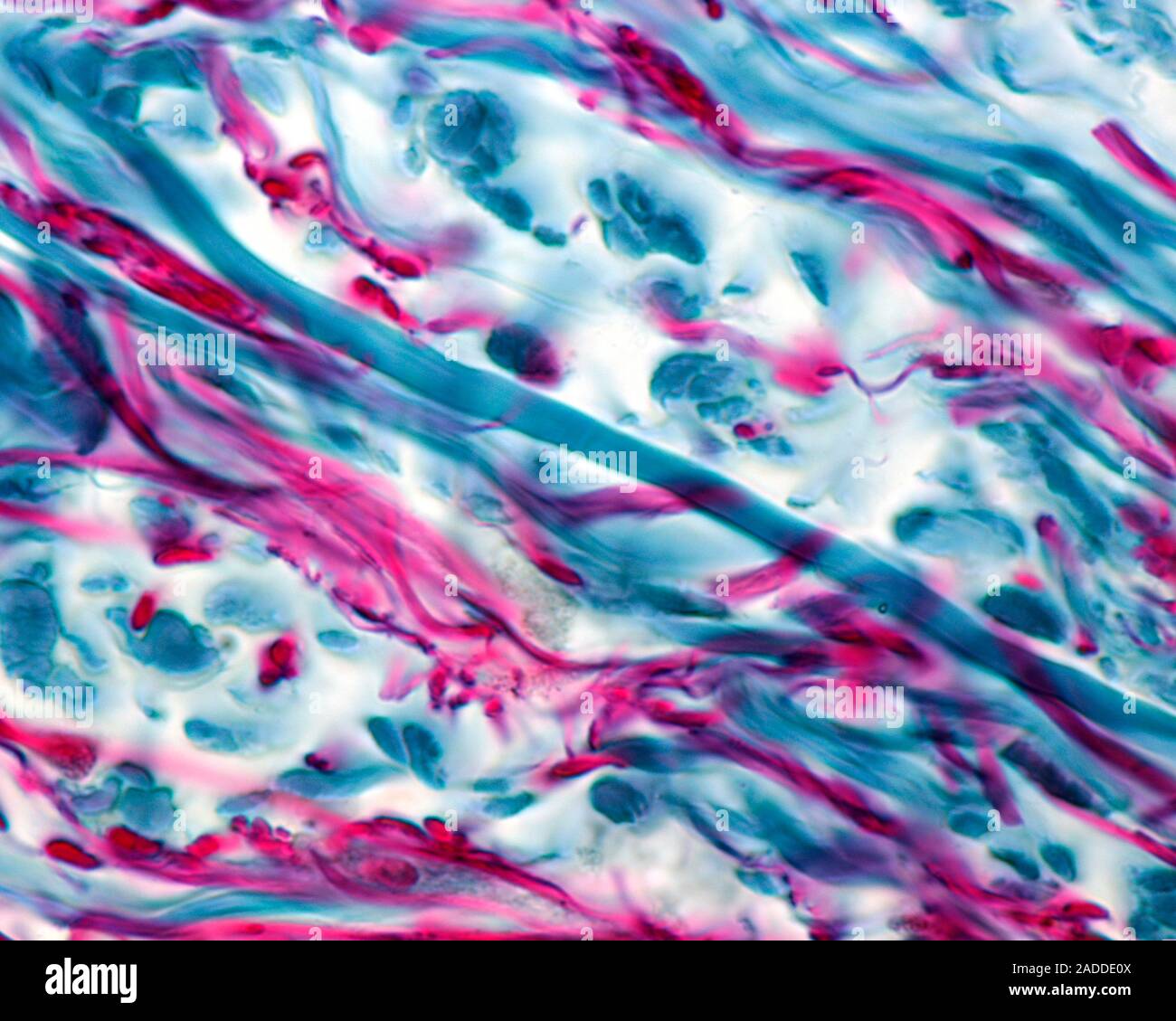 Light micrograph of a dermis skin tissue stained with Cajal-Gallego ...
