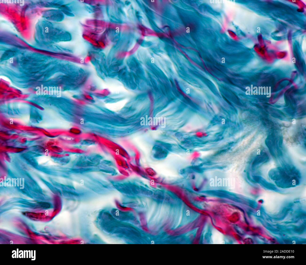 Light micrograph of a dermis skin tissue stained with Cajal-Gallego ...