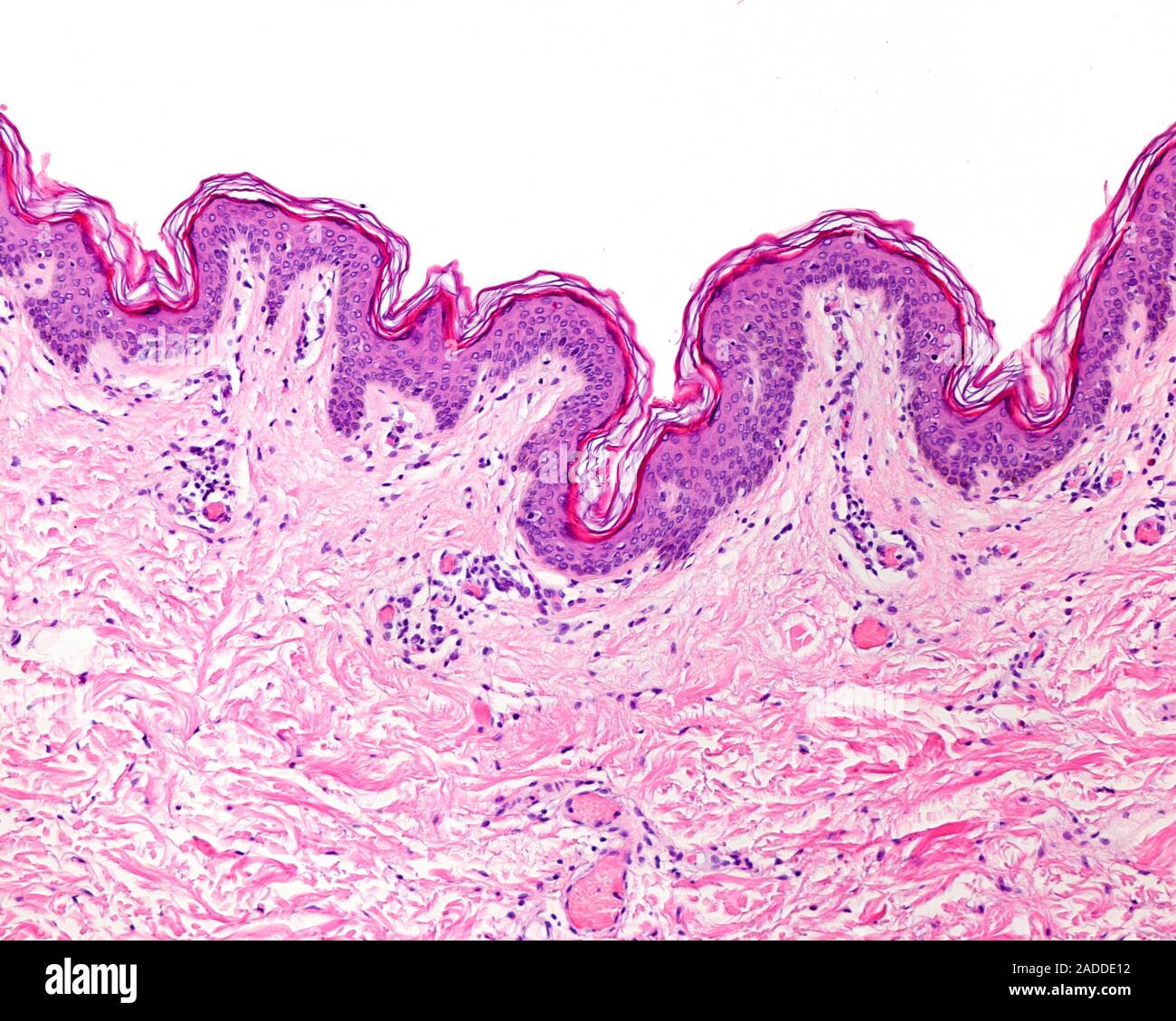 Skin epidermis, light micrograph. The epidermis is the outer layer of ...
