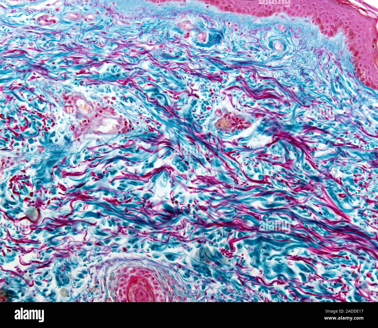 Light micrograph of a section through the dermis of the skin stained ...