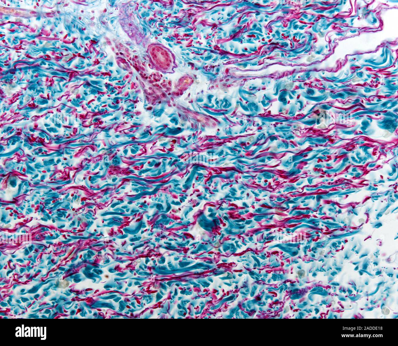 Light micrograph of a section through the dermis of the skin stained ...