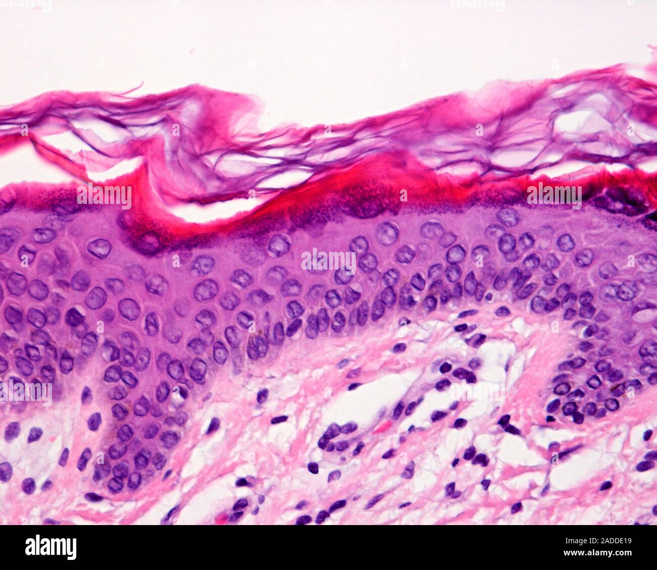 Skin epidermis, light micrograph. The epidermis is the outer layer of ...