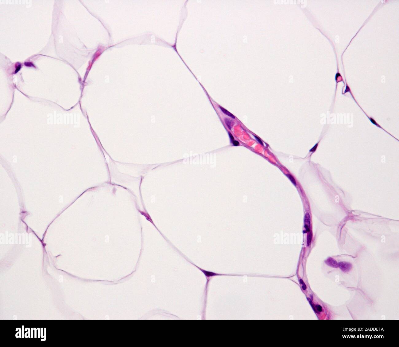 Capillary between fat cells, light micrograph. Erythrocytes (red blood ...