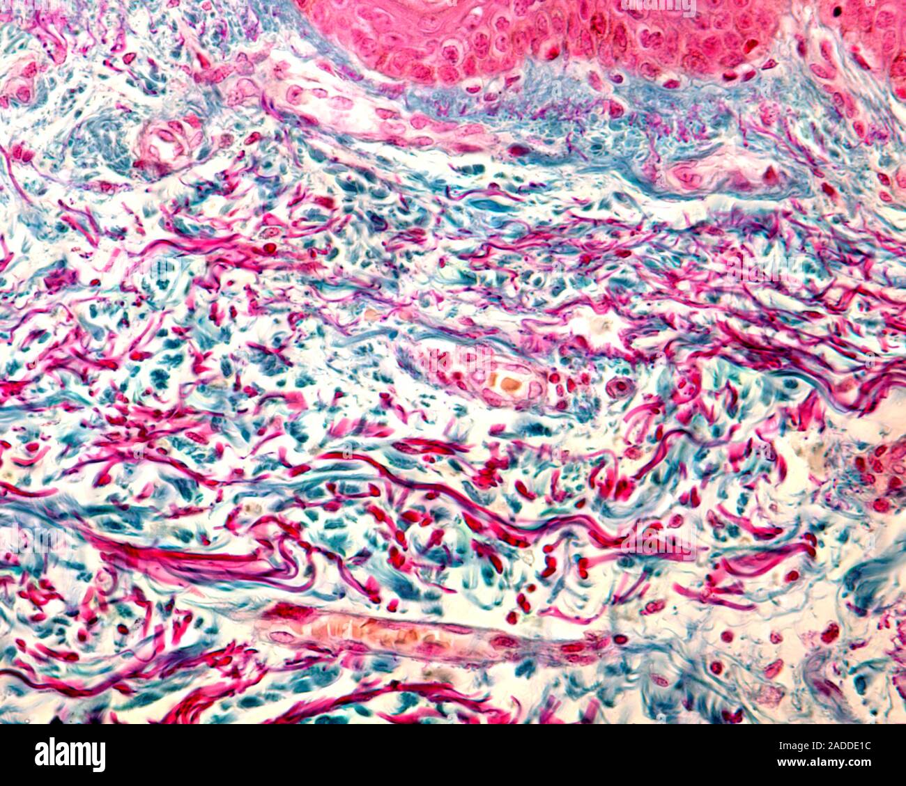 Light micrograph of a section through the dermis of the skin stained ...