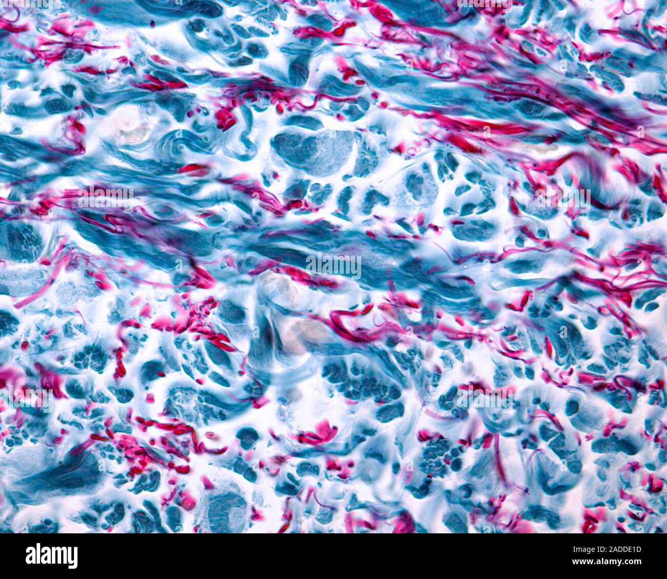 Light micrograph of a section through the dermis of the skin stained ...