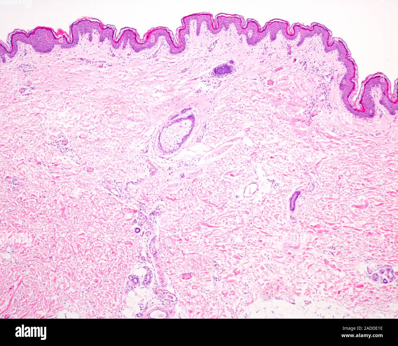 Light micrograph of thin skin showing the epidermis (purple) and the ...